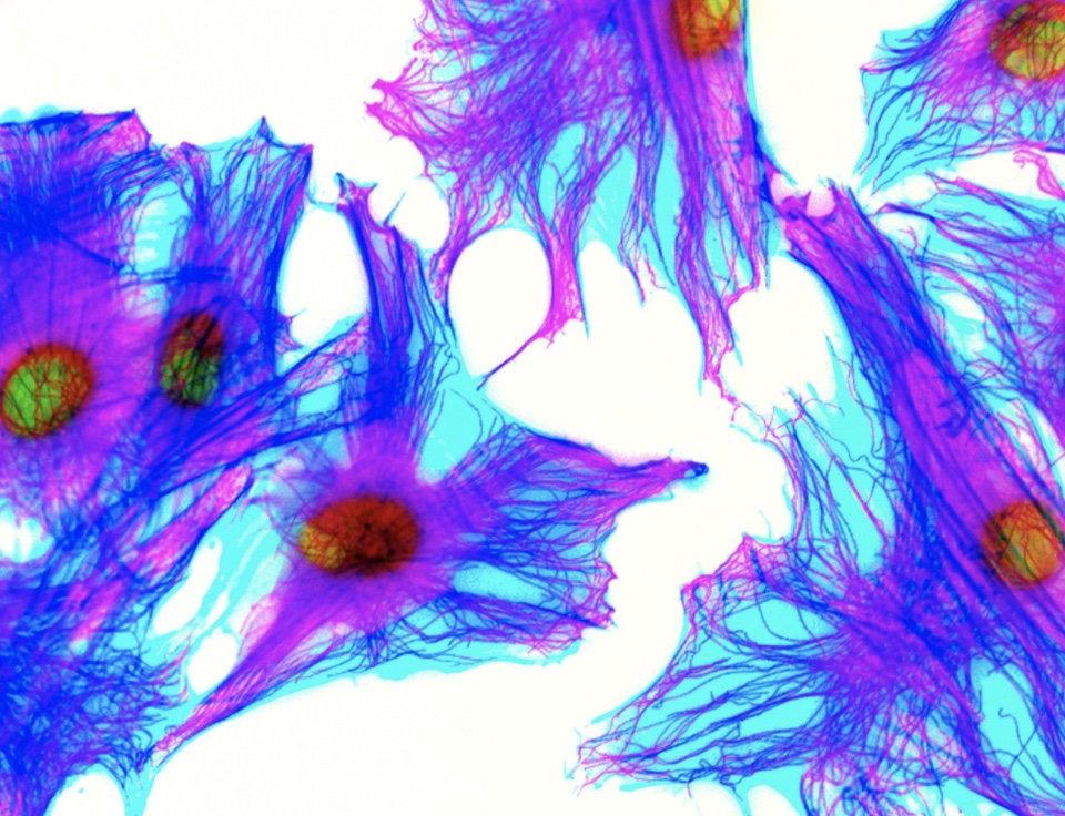 Using catalogue knockout cell lines | CiteAb Blog