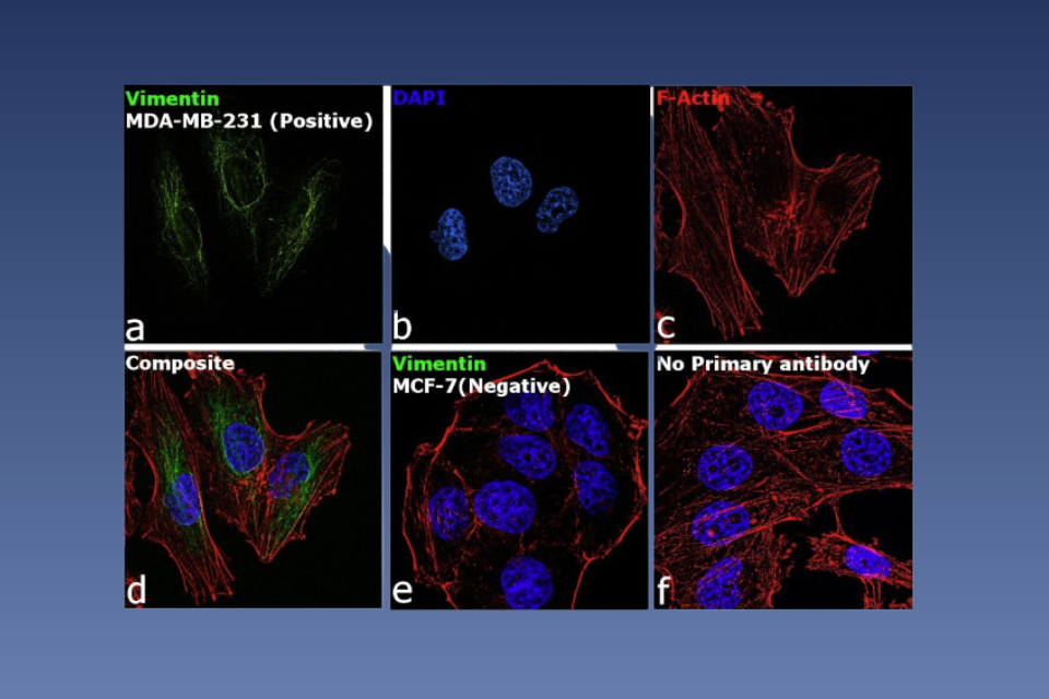 Exploring antibody validation approaches with AbVal meeting speakers ...